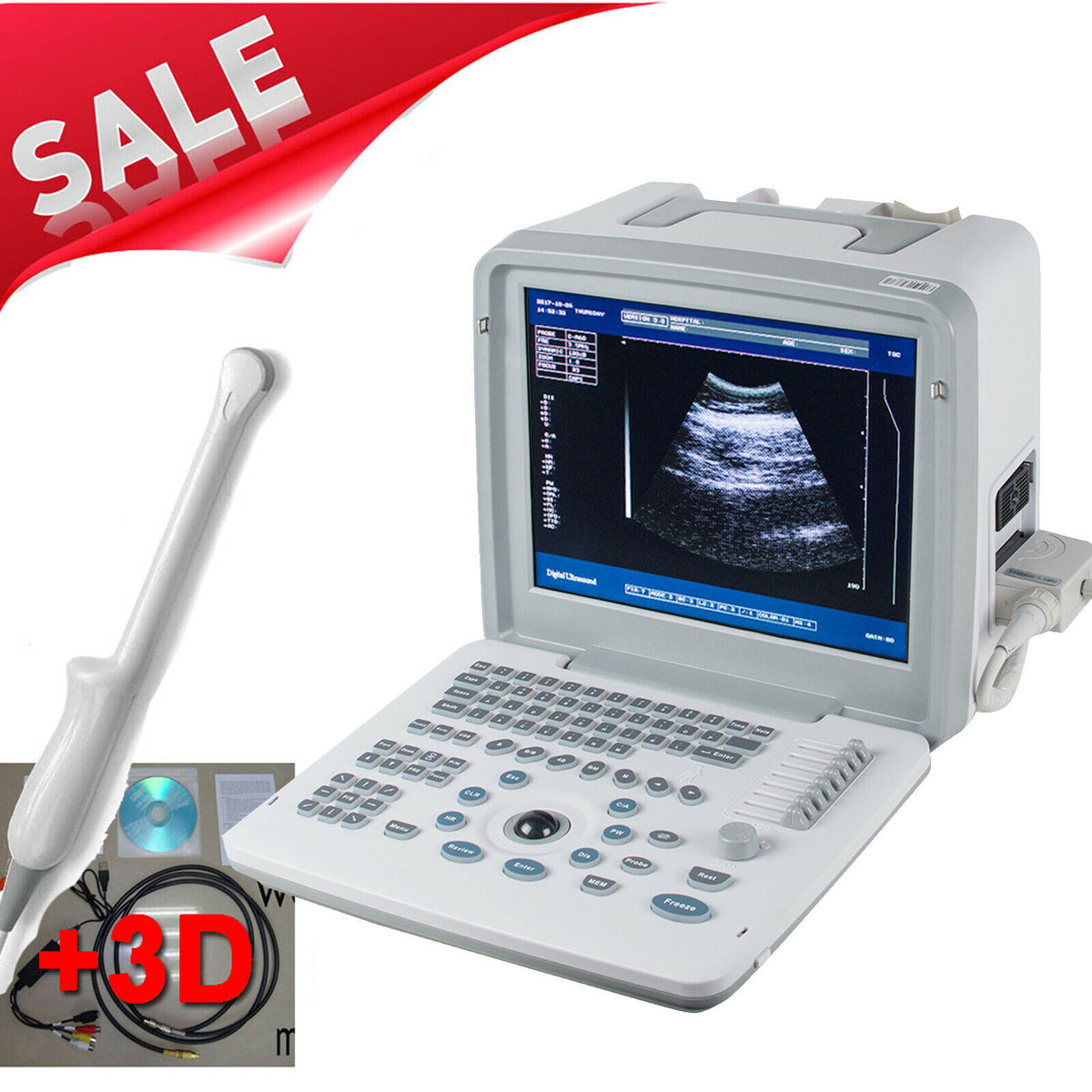 LCD Full Digital Portable Ultrasound Scanner Machine +7.5 Transvaginal – DIAGNOSTIC ULTRASOUND ...