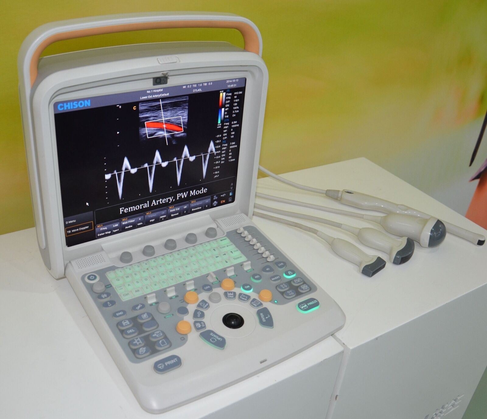 Color Doppler Ultrasound Chison Q5, with 4D Probe for Obstetrics and
