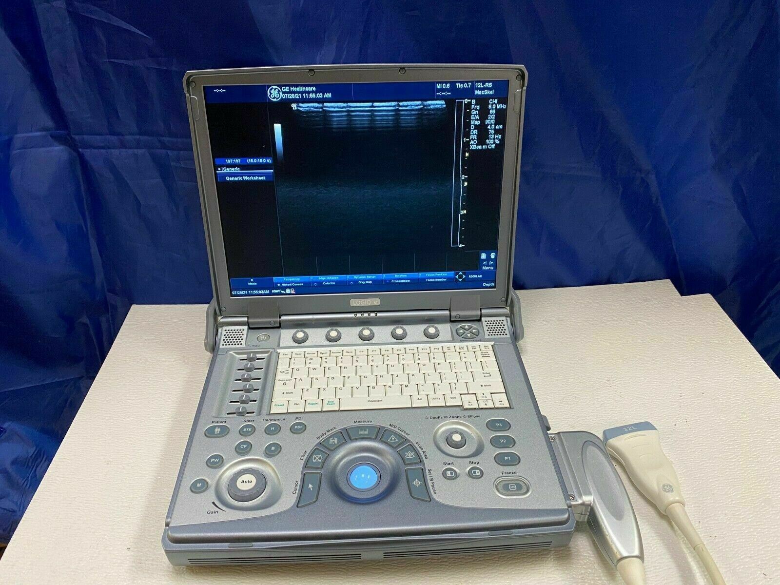 GE LOGIQ E PORTABLE ULTRASOUND MACHINE WITH 1 PROBE (12L) MANUFACTURED