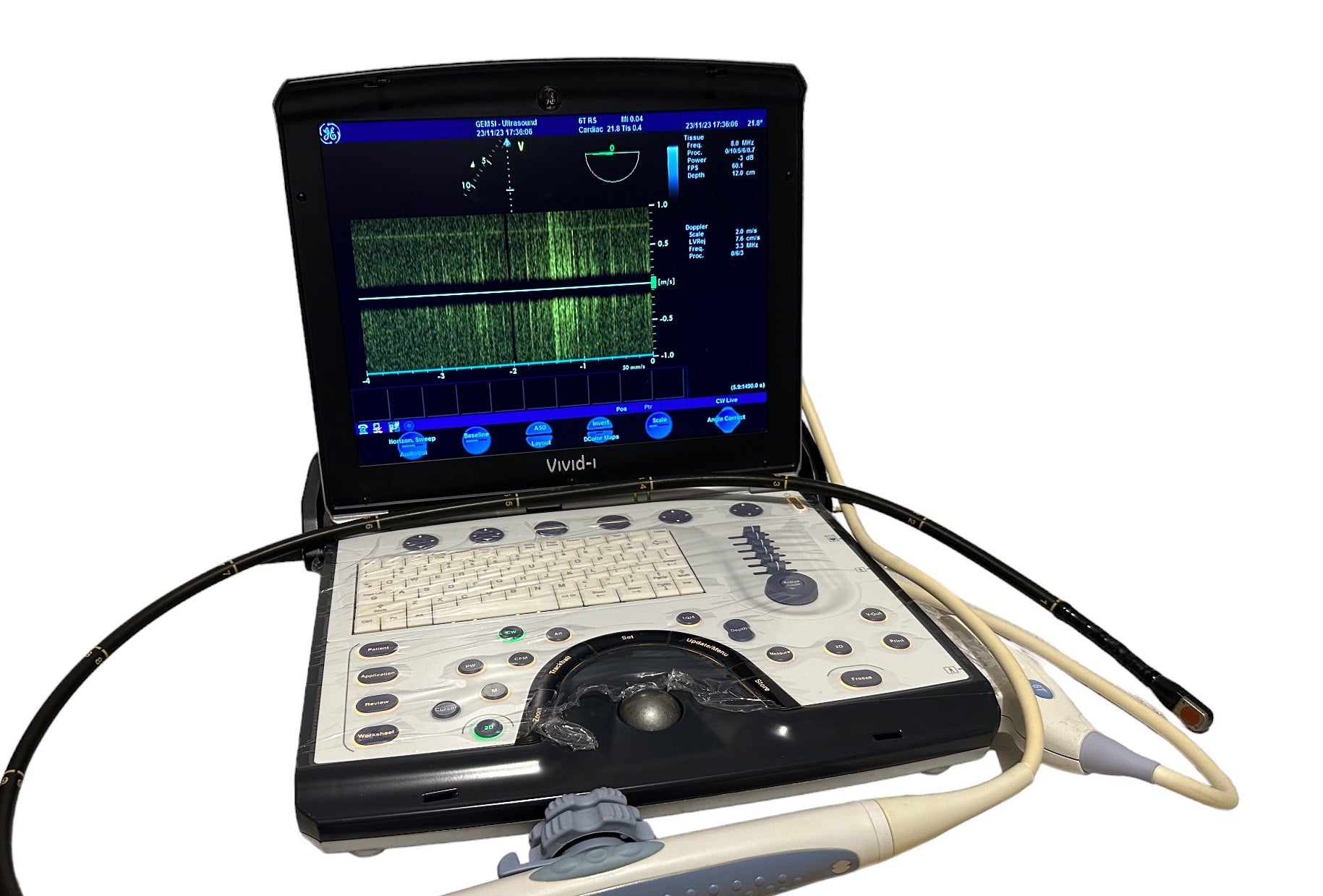 GE Vivid I Color Doppler Ultrasound & 6T TEE Probe - DIAGNOSTIC