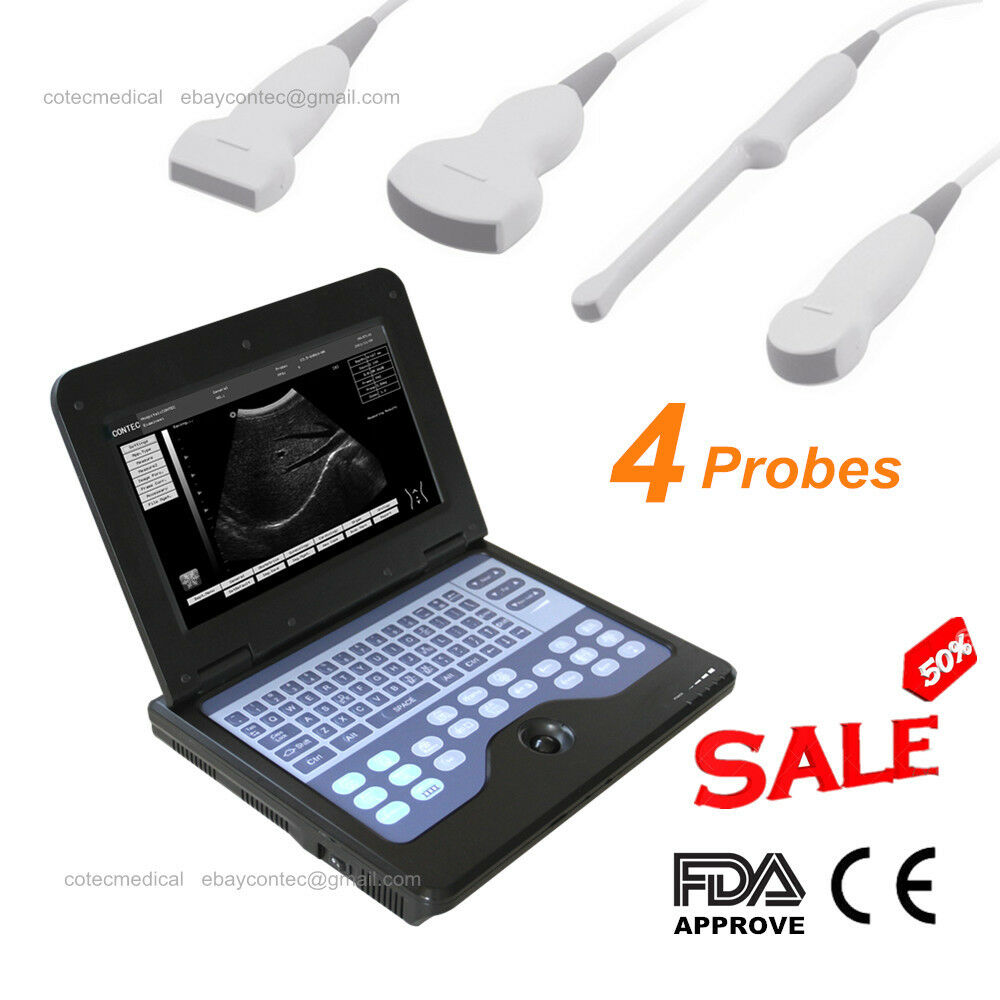 Portable Laptop Ultrasound Scanner + Convex/Linear/Cardiac/Transvagina – DIAGNOSTIC ULTRASOUND ...