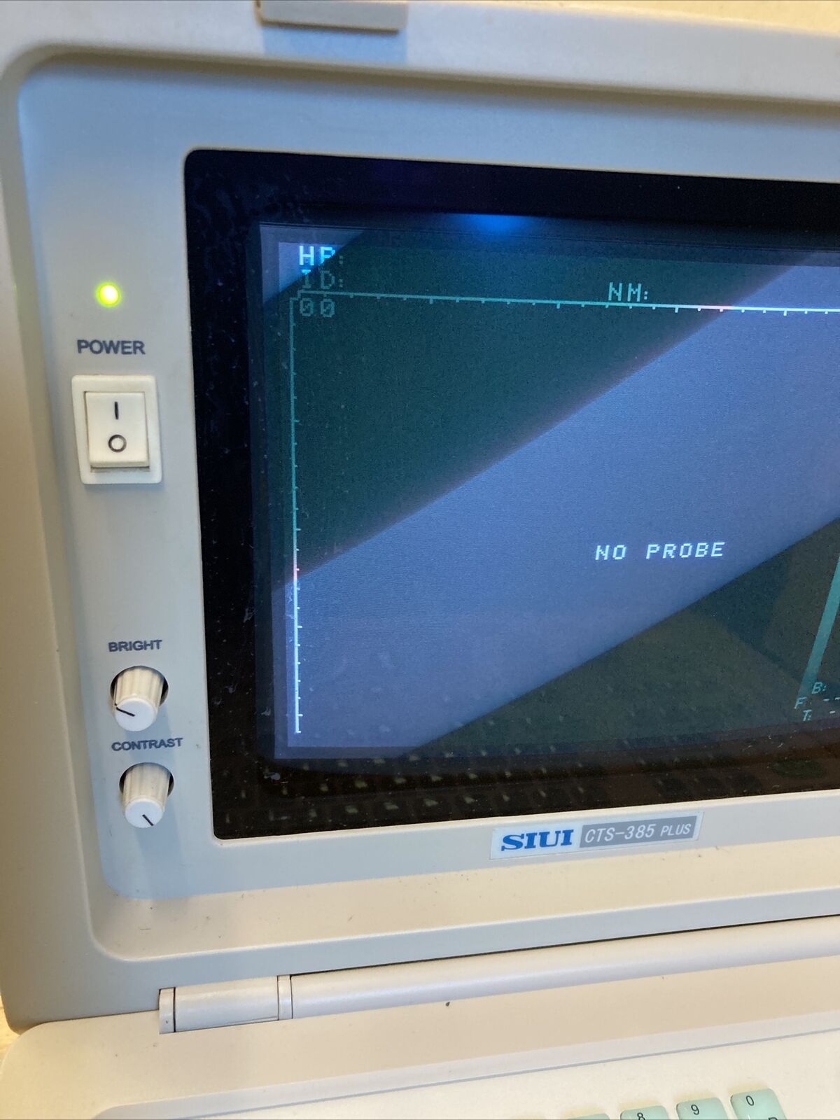 SIUI Portable Ultrasound Model CTS-385 PLUS – DIAGNOSTIC ULTRASOUND ...