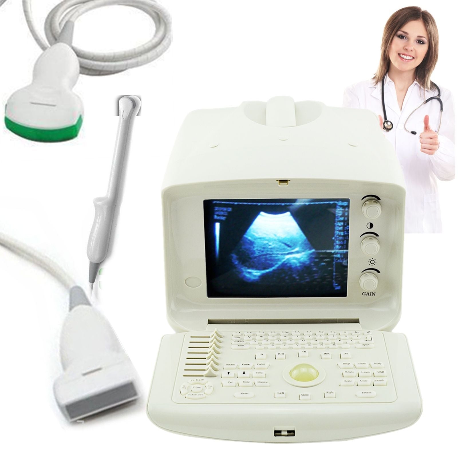 Portable 3D Ultrasound Scanner Machine system Convex & Vaginal
