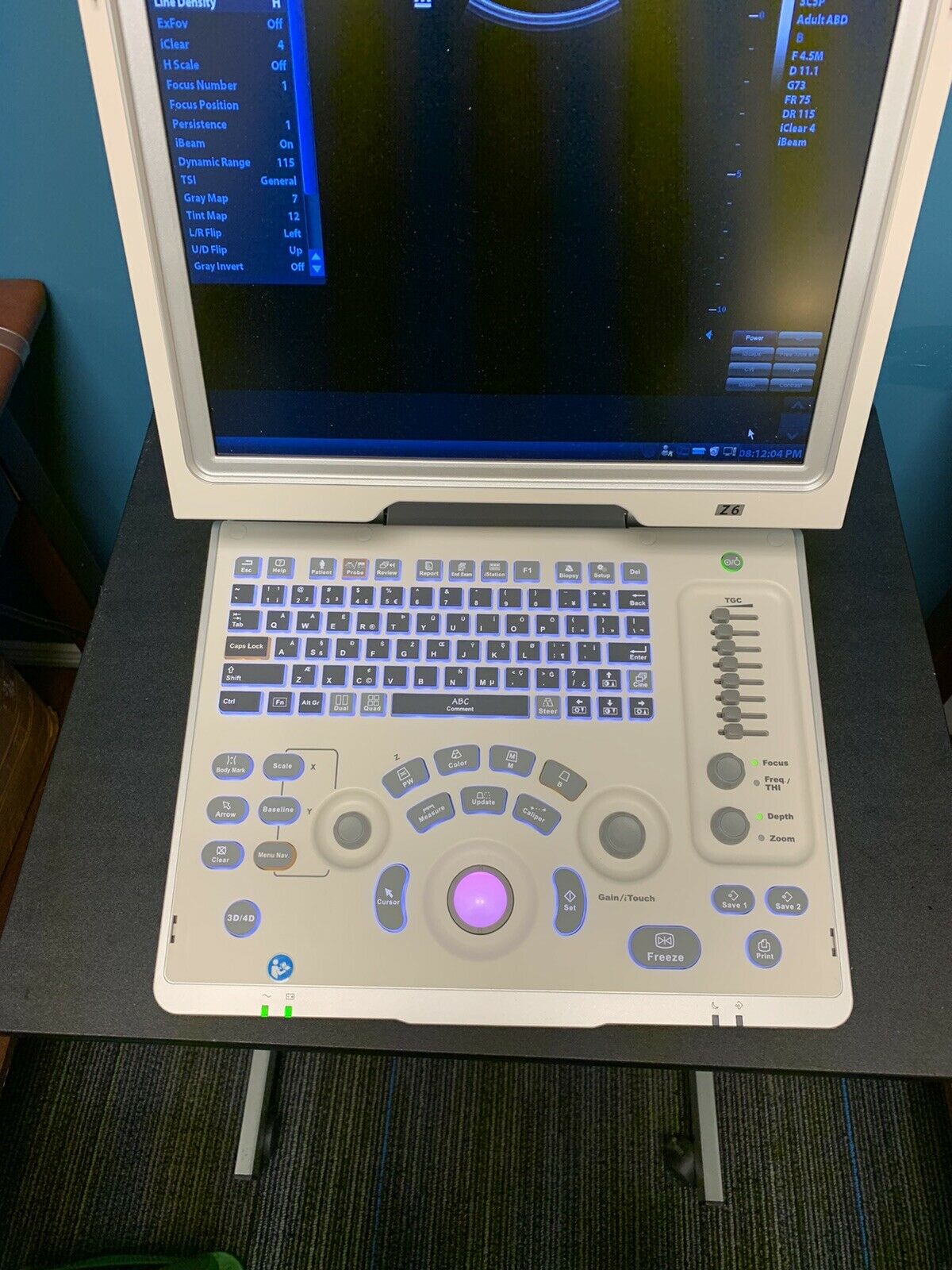 MINDRAY Z6 Portable Ultrasound - Advanced Diagnostic Tool