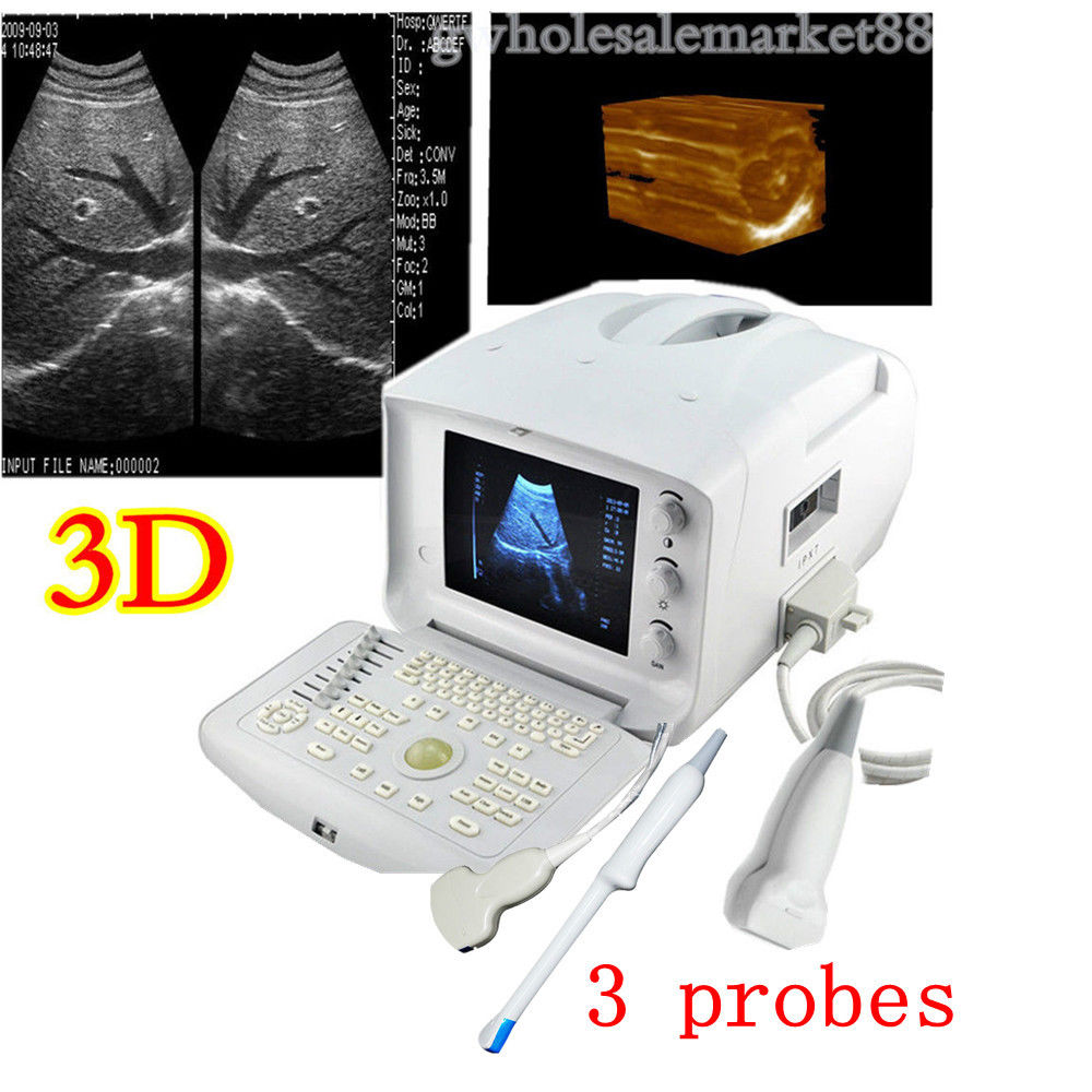 Medical 3D Portable Ultrasound Diagnose Scanner Convex Linear